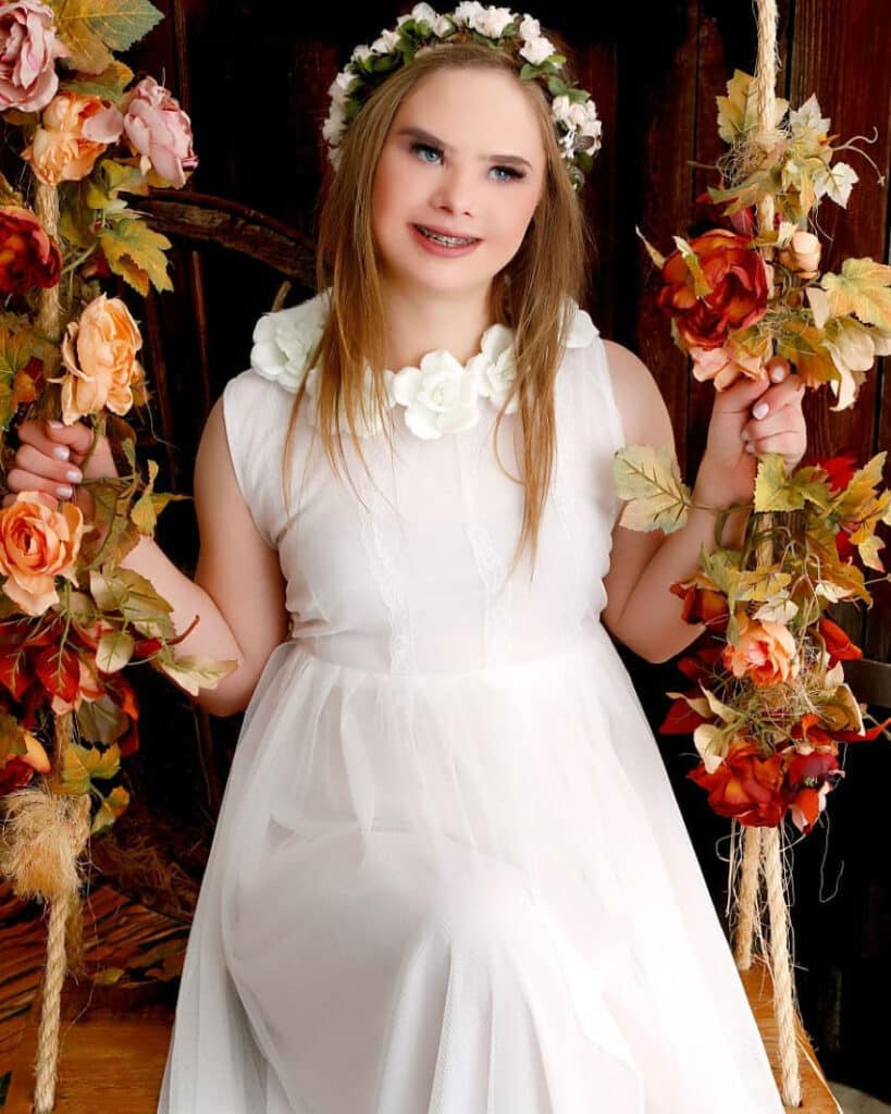Down's Syndrome Model – Inspiring Girl on a Road to Success and Fame