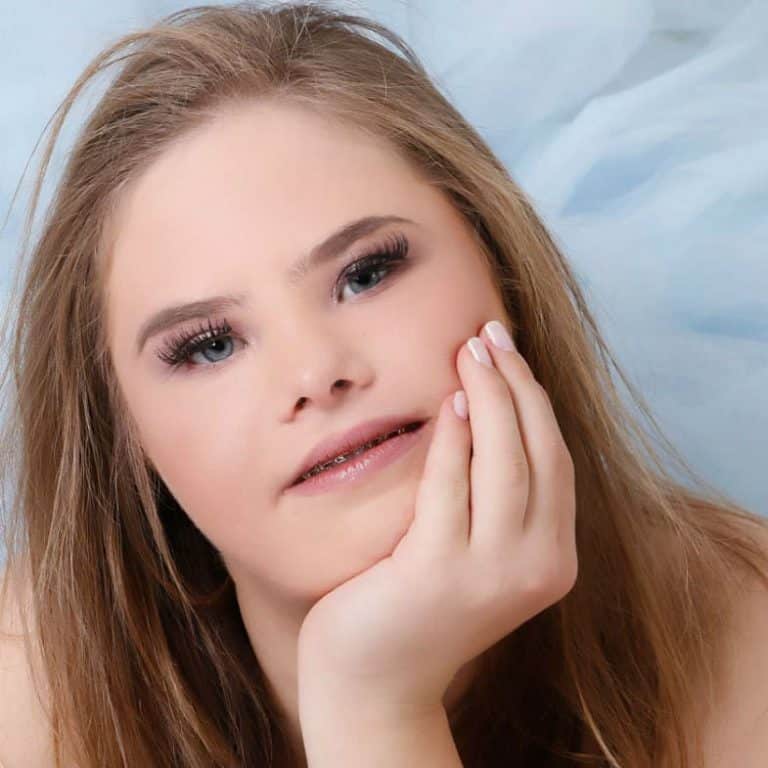 Down's Syndrome Model – Inspiring Girl on a Road to Success and Fame