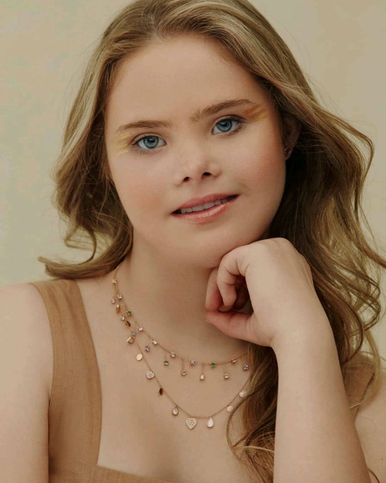 Down's Syndrome Model – Inspiring Girl on a Road to Success and Fame